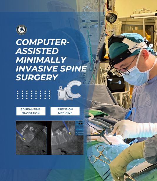 3D Computer-Assisted Minimally Invasive Spine Surgery | Safe & Precise ...