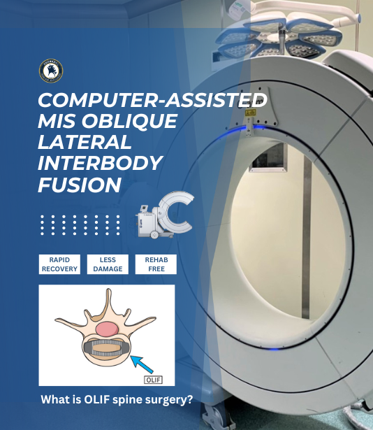 3D Computer-Assisted OLIF Minimally Invasive Spine Surgery | Expert ...