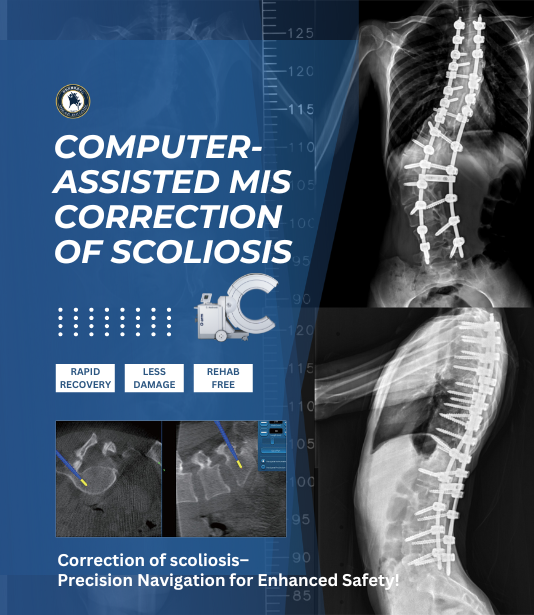 3D Computer-Assisted Scoliosis Correction Surgery | Safe & Precise ...